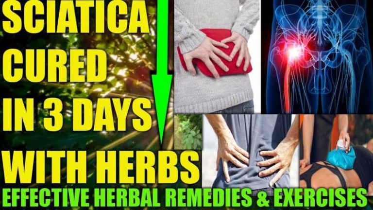 3 Best Natural Cures For Sciatica Pain [Home Remedies]